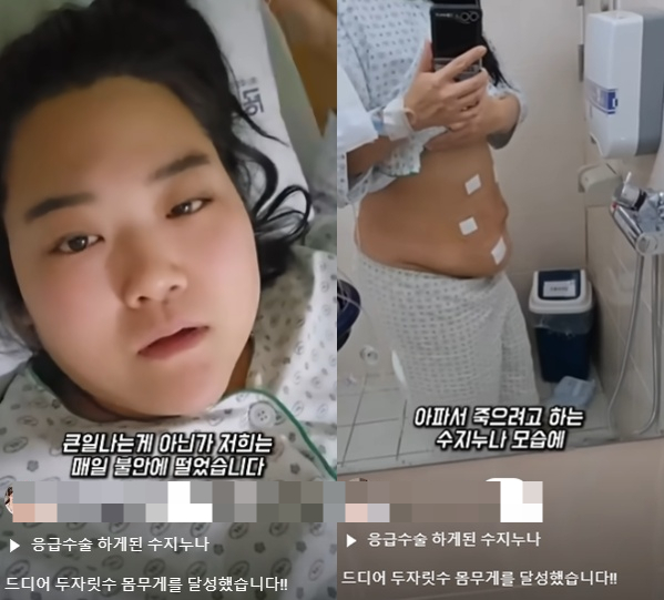미나 시누이 박수지, 150kg→99kg 감량 후 탈장 수술 성공… "새 삶 시작"